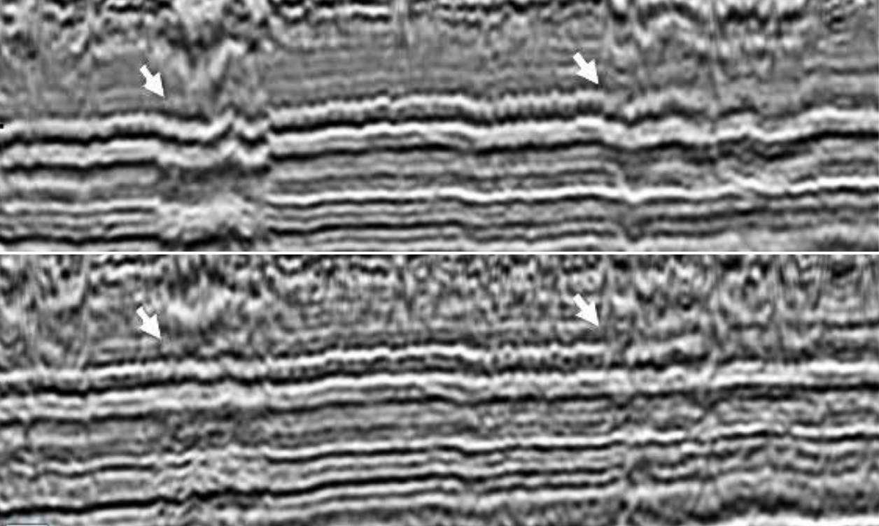 Subsurface Imaging | TGS Imaging & Processing